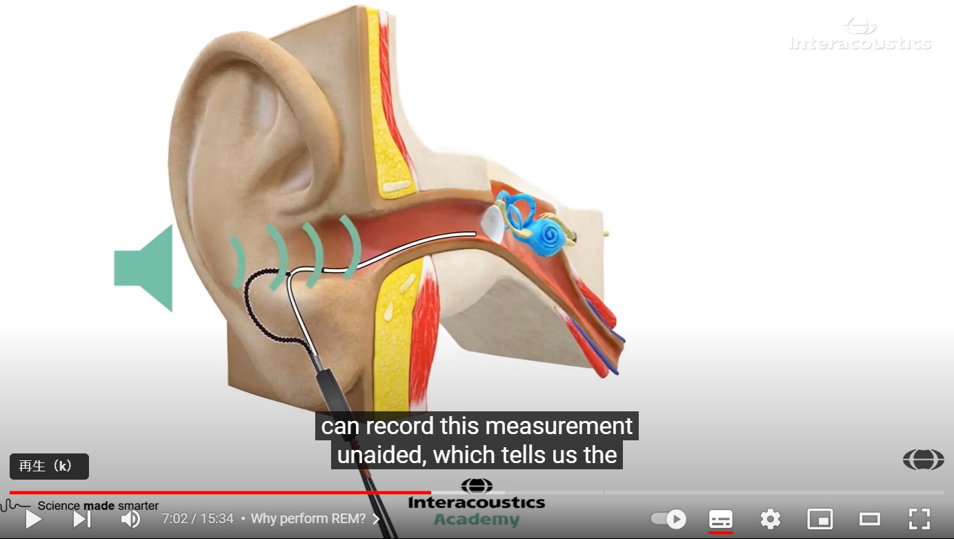 オーティコン補聴器(oticon) 2024年モデル「インテント（Intent)」登場！リアルからの変更点をまとめました | 創業から40年 ...